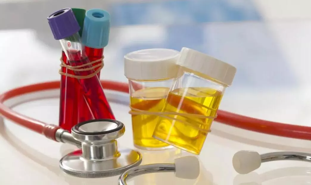 How UTI Causes Vaginal Odor? What is The Connection? | Gynin