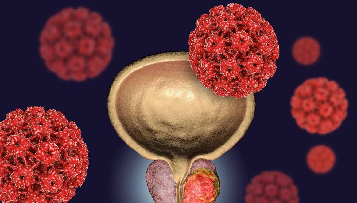 What Are The Vaginal Cancer Smell Like? | Gynin